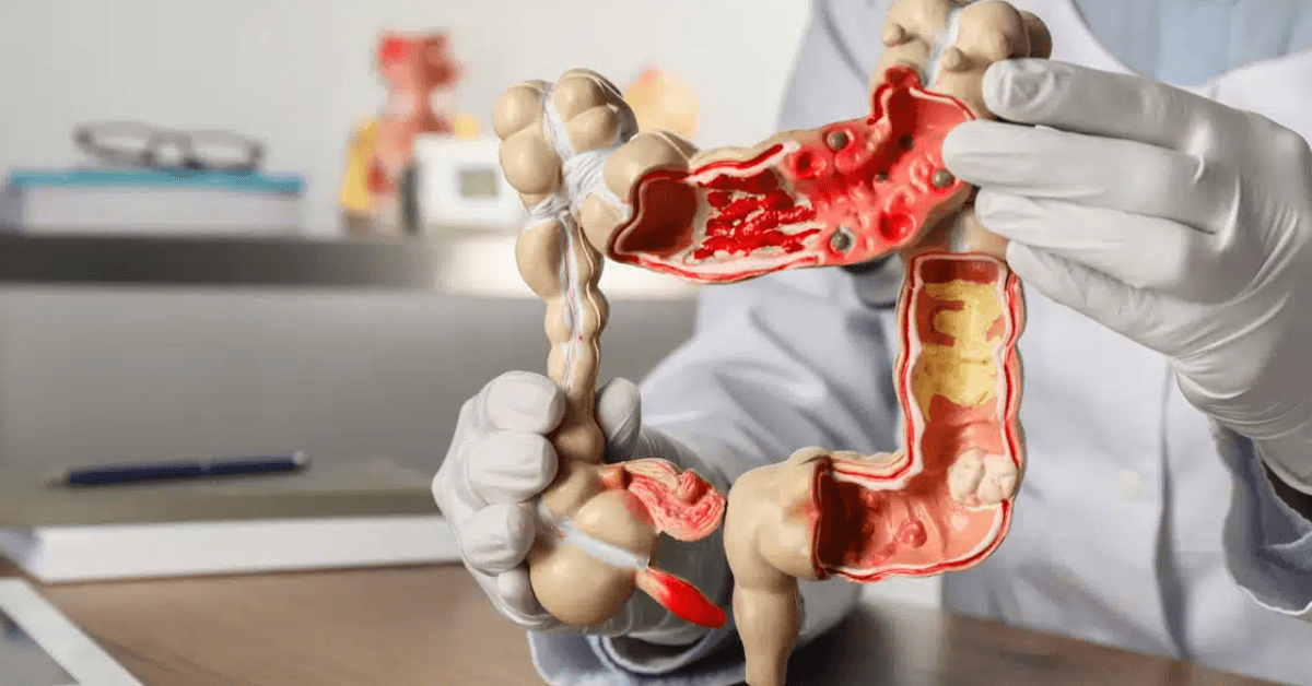 Gastroenterology Care Platform | SmartCare360 Solutions